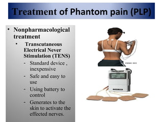 Phantom limb treatment | PPT