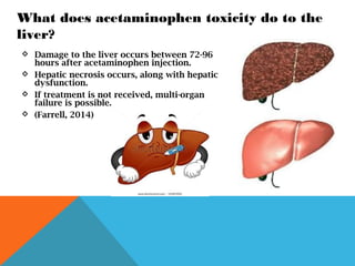 Pharmacology - Toxicity | PPS