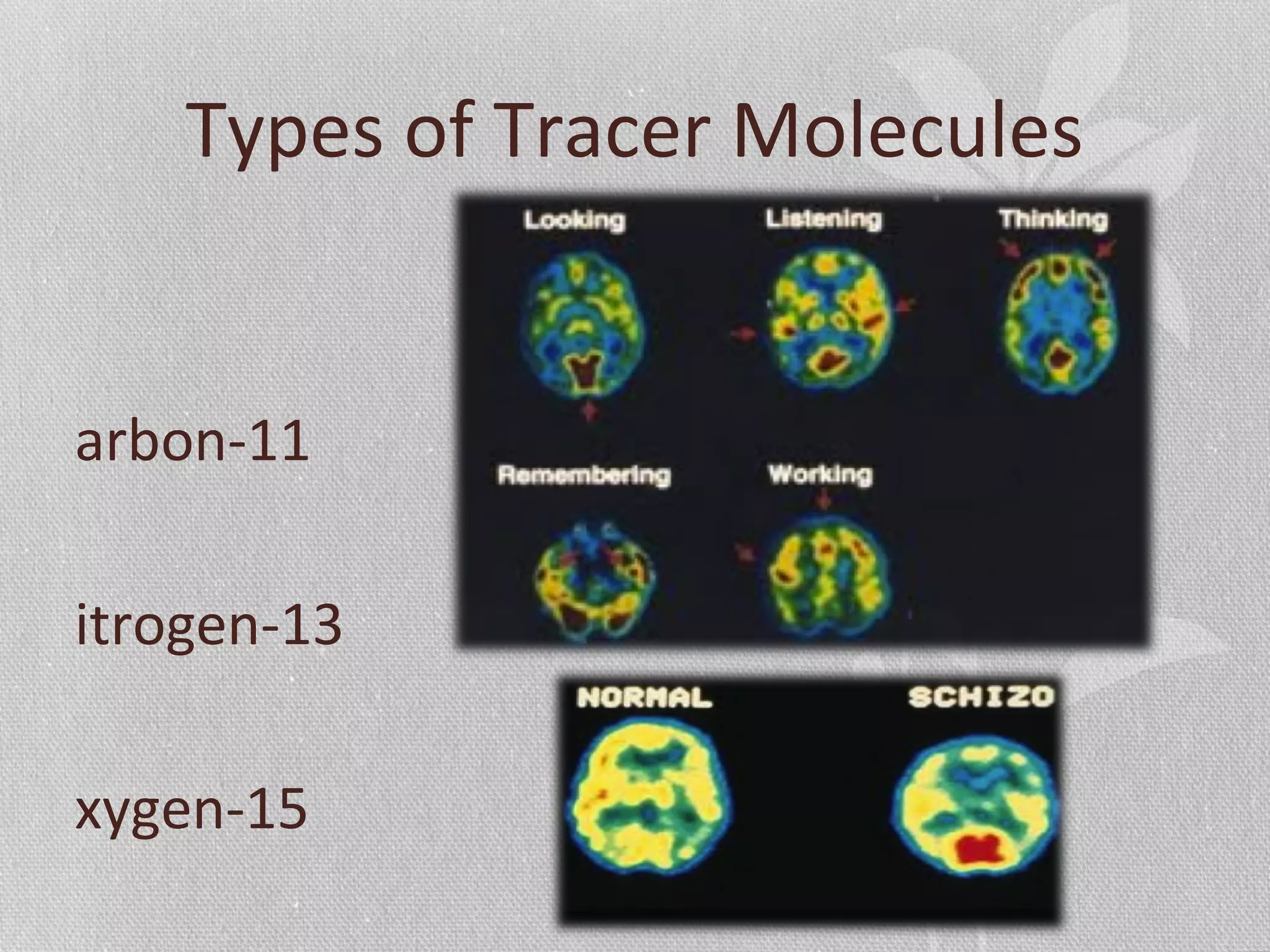 Radiopharmaceuticals: Positron Emmison Tomography | PPT