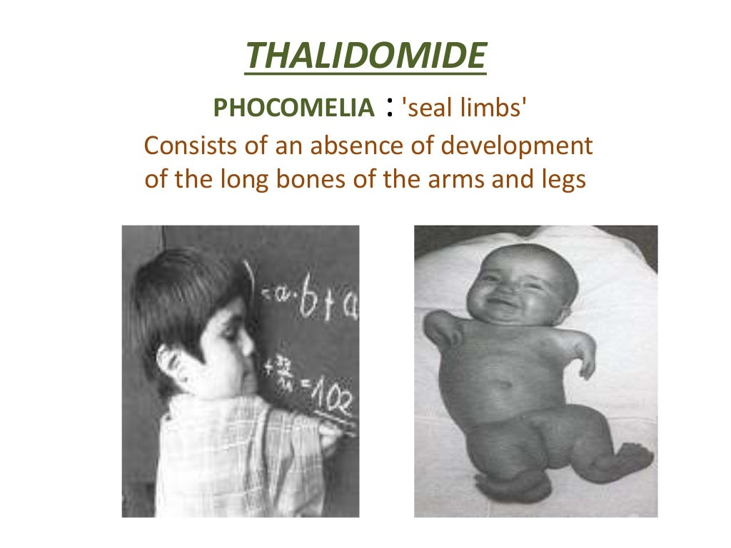 Pharmacogenetics & Teratogenicity