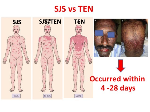 Pharmacogenomic in neurology ii