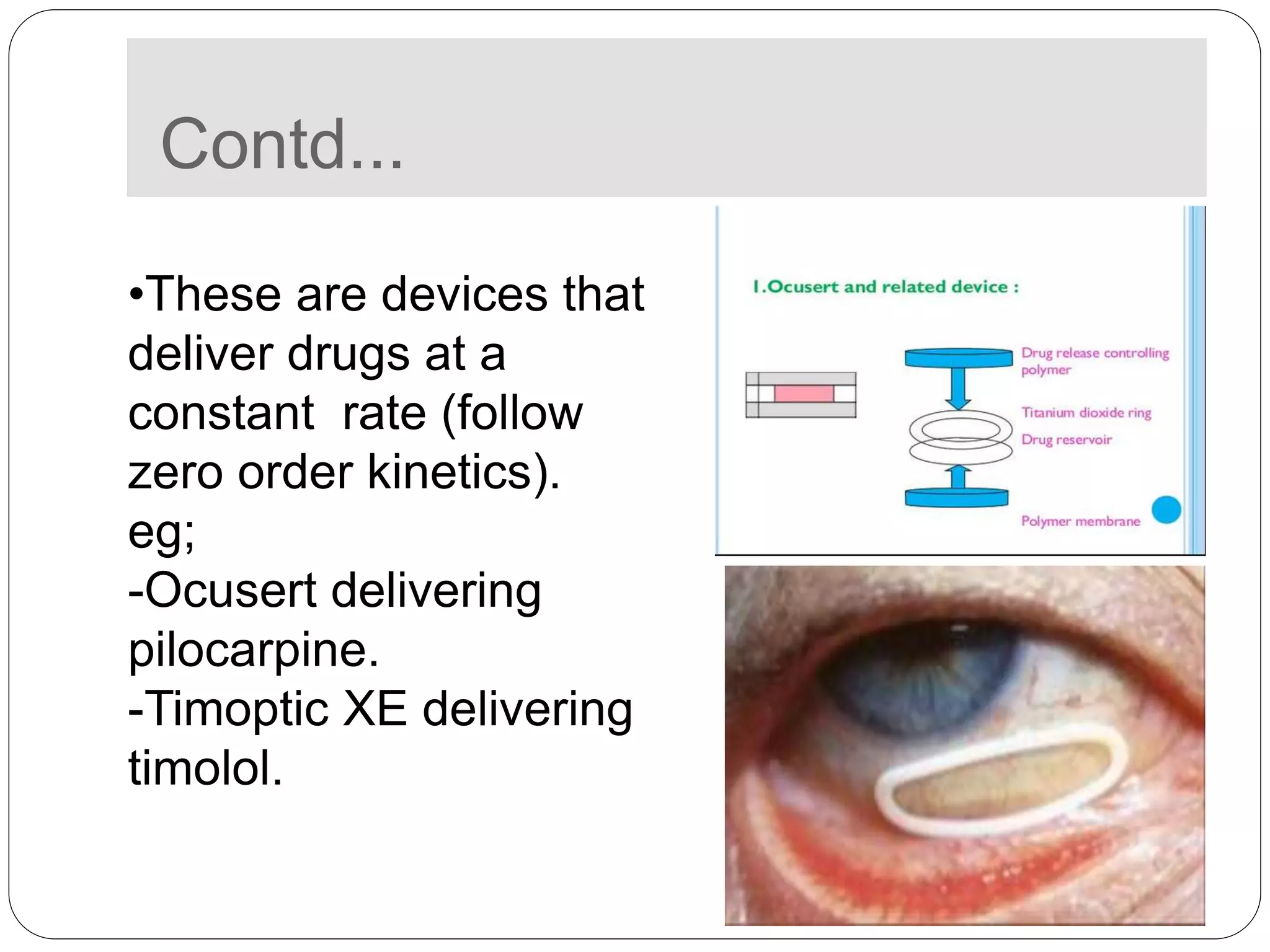 Pharmacokinetics and toxicology of ocular therapy | PPTX