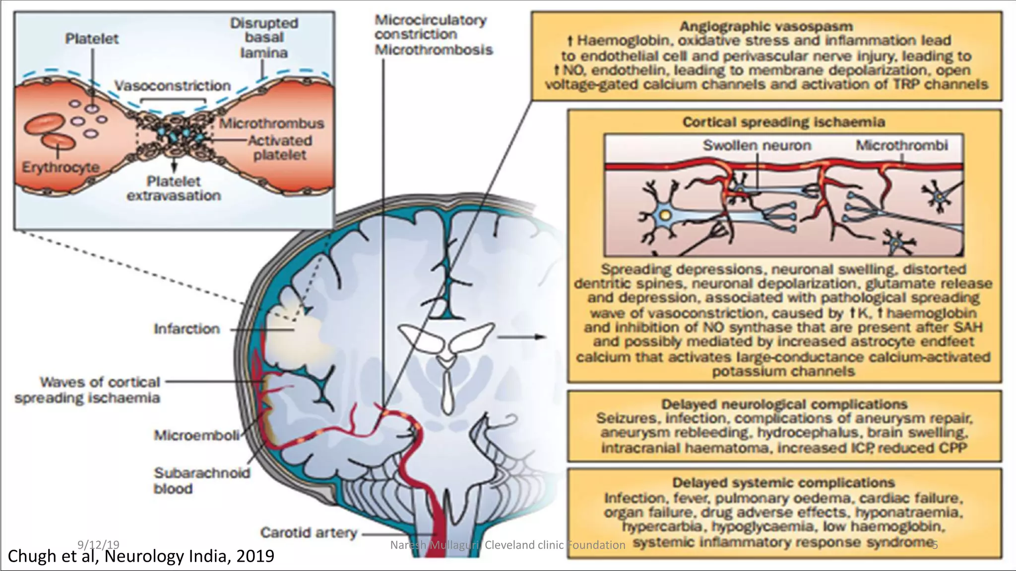 Pharmacological management of cerebral vasospasm in subarachnoid hemorrhage | PPT