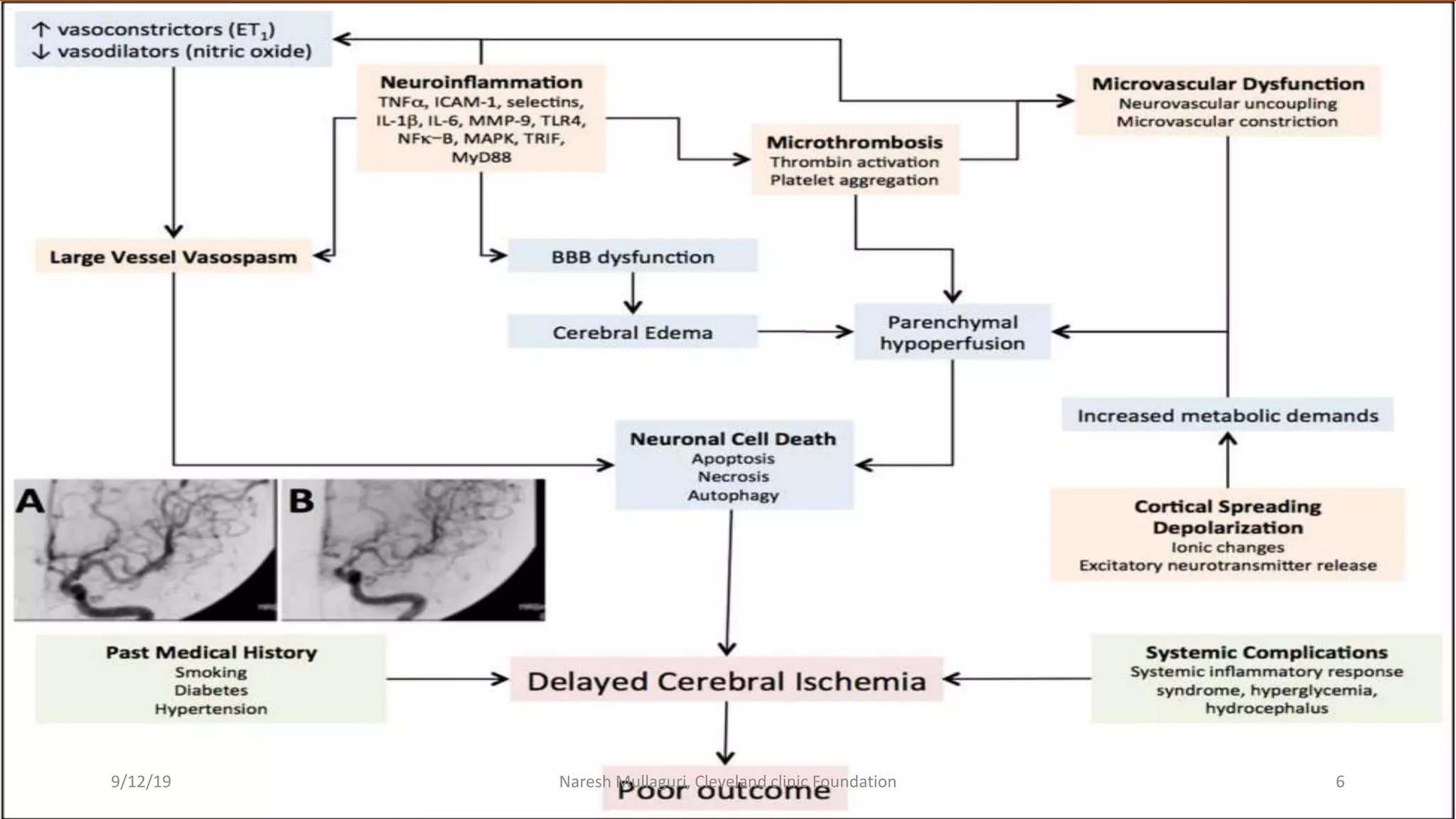 Pharmacological management of cerebral vasospasm in subarachnoid hemorrhage | PPT