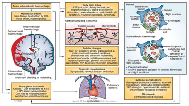 Pharmacological management of cerebral vasospasm in subarachnoid hemorrhage | PPT