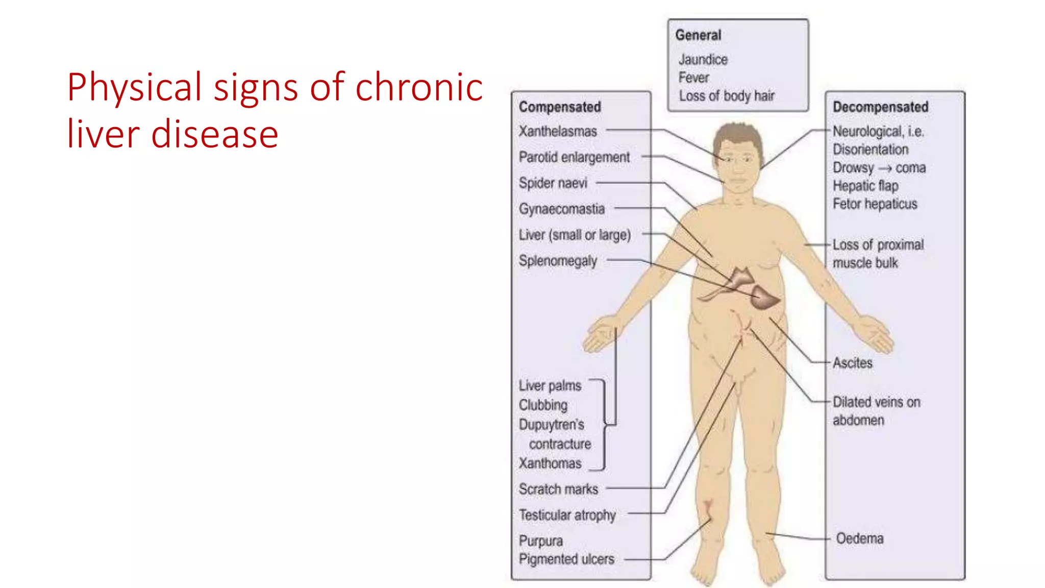 Pharmacological management of chronic liver disease | PPTX