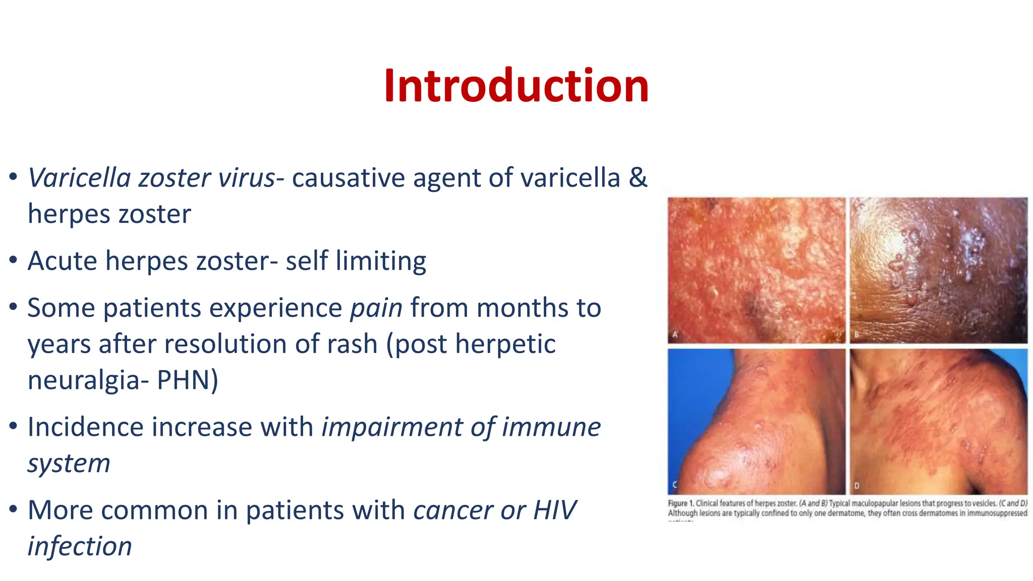 Pharmacological Management of Post-Herpetic Neuralgia.pptx