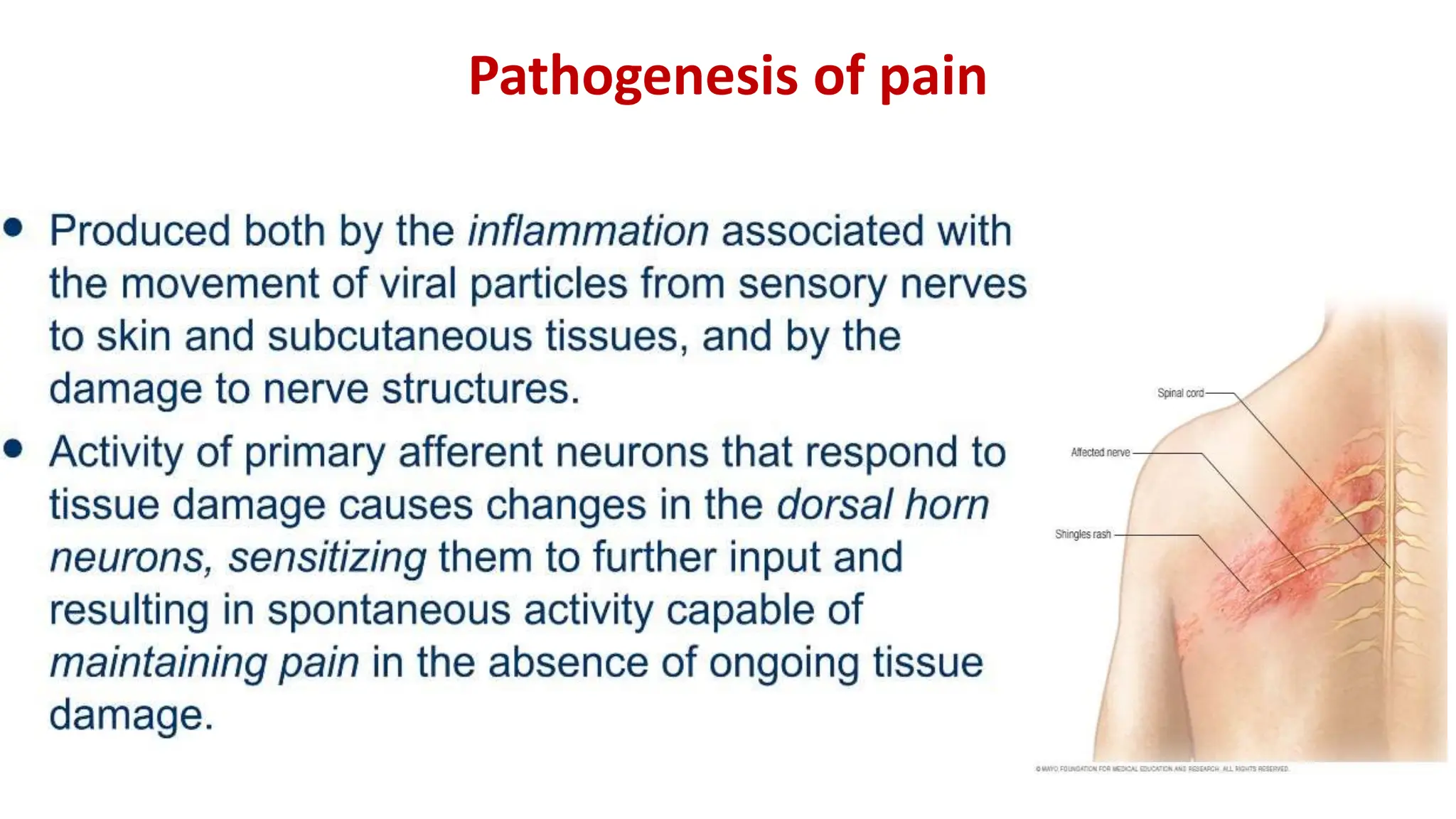 Pharmacological Management of Post-Herpetic Neuralgia.pptx