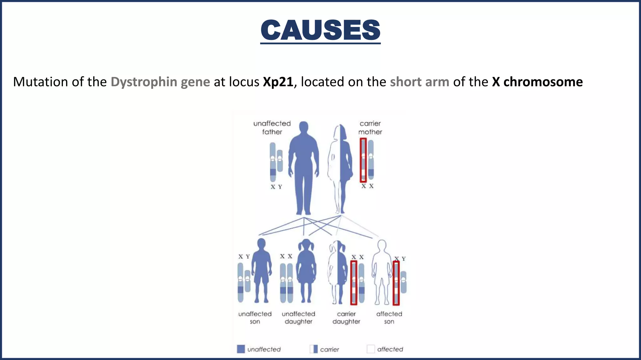 DUCHENNE MUSCULAR DYSTROPHY | PPTX