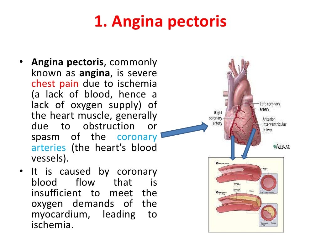 pharmacology-angina