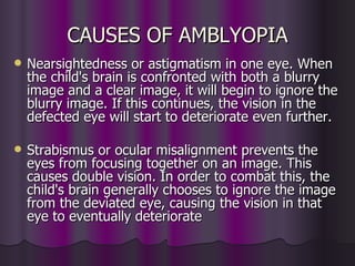 Pharmacology eye disorders | PPT