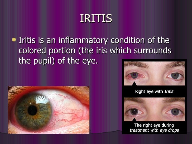 Pharmacology eye disorders