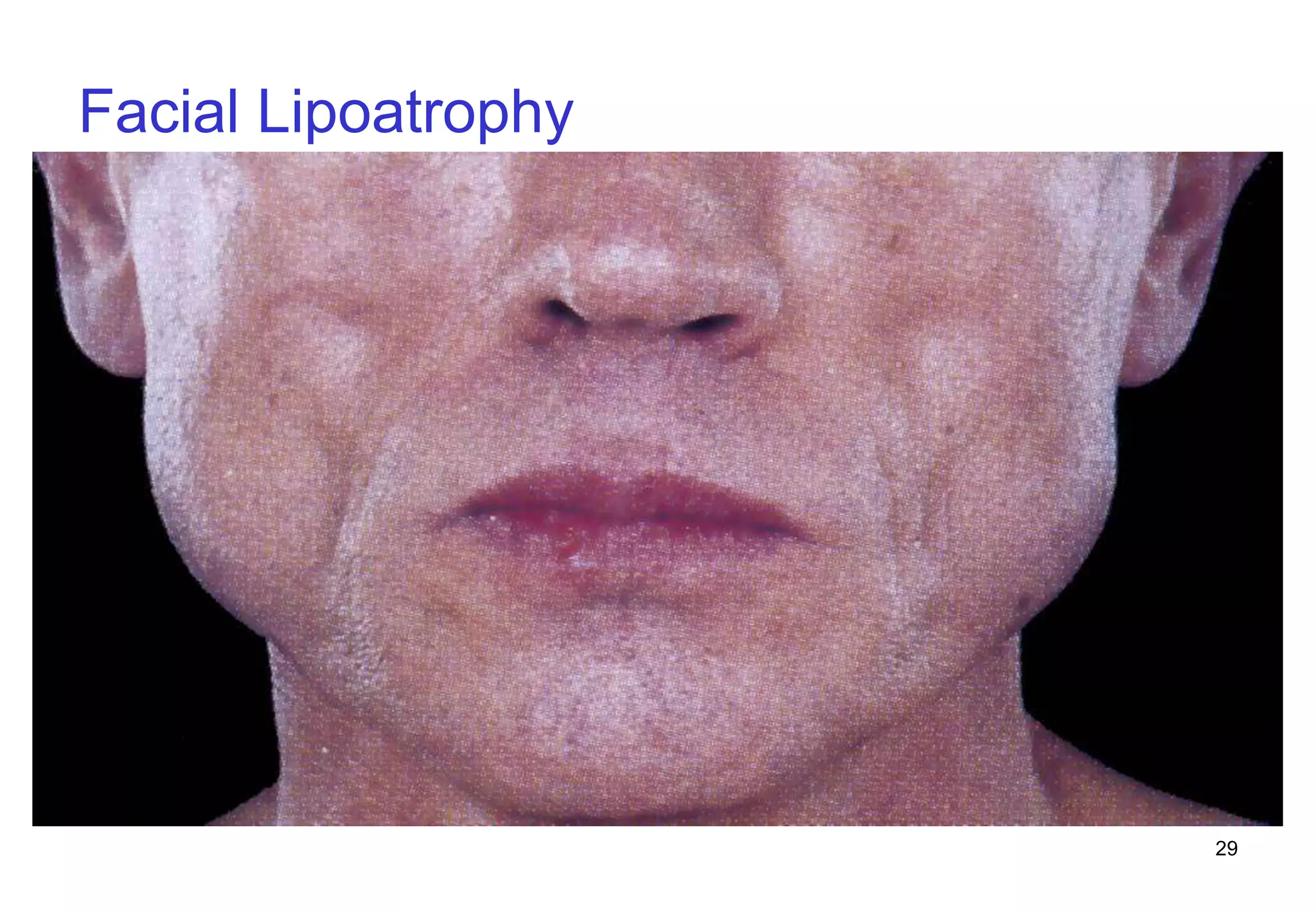 Pharmacology_F.ppt