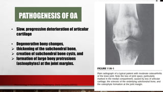 Pharmacology for RA-OA Ikhsan 2021 | PDF