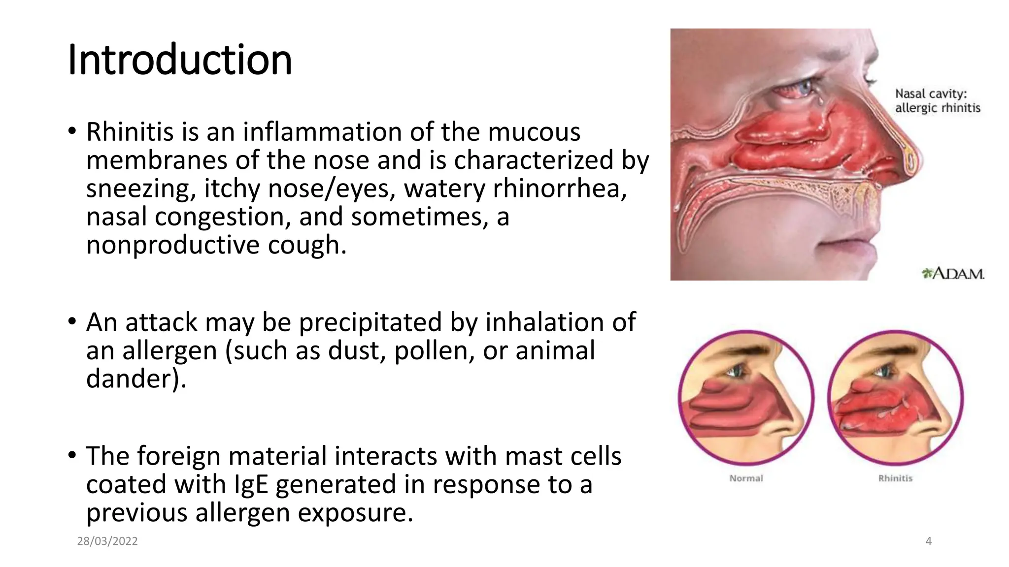 Pharmacology of drugs for allergic rhinitis and common.pptx