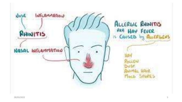 Pharmacology of drugs for allergic rhinitis and common.pptx