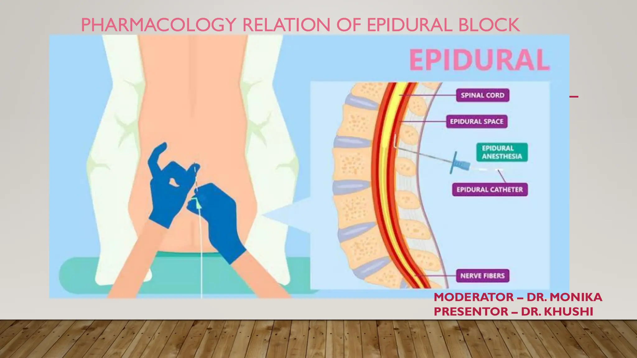 Pharmacology of epidural block presentation | PDF