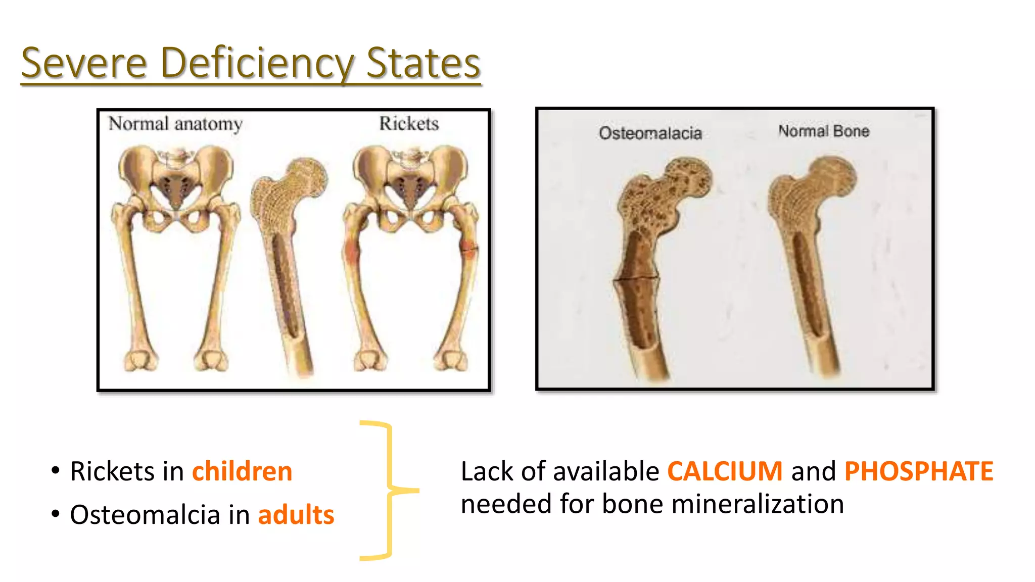 Pharmacotherapeutics of Vitamin D | PPTX