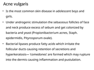 Pharmacotherapy o f Acne Vulgaris.pptx