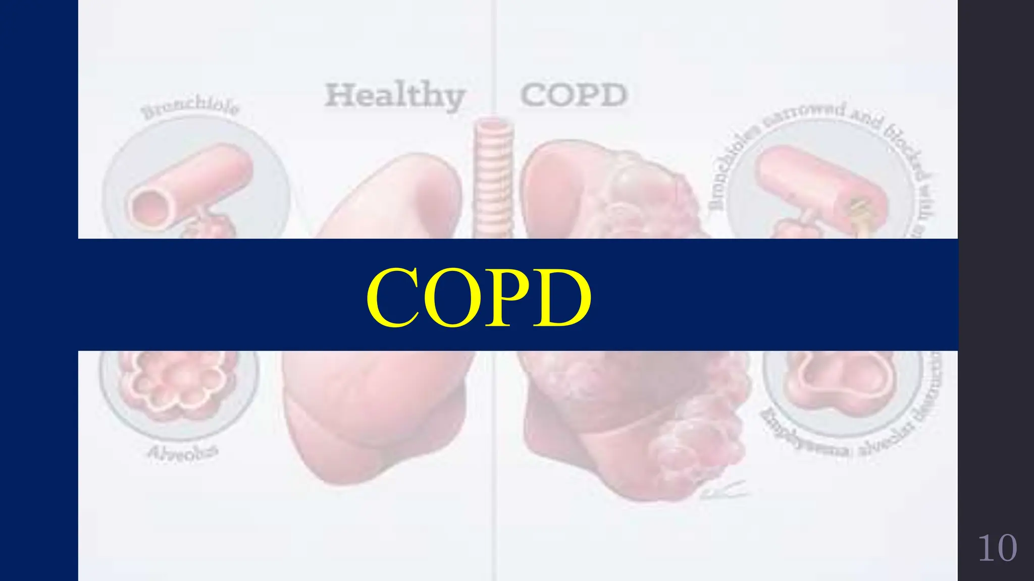 Pharmacotherapy of Asthma and Chronic Obstructive Pulmonary Disease (COPD) | PPTX