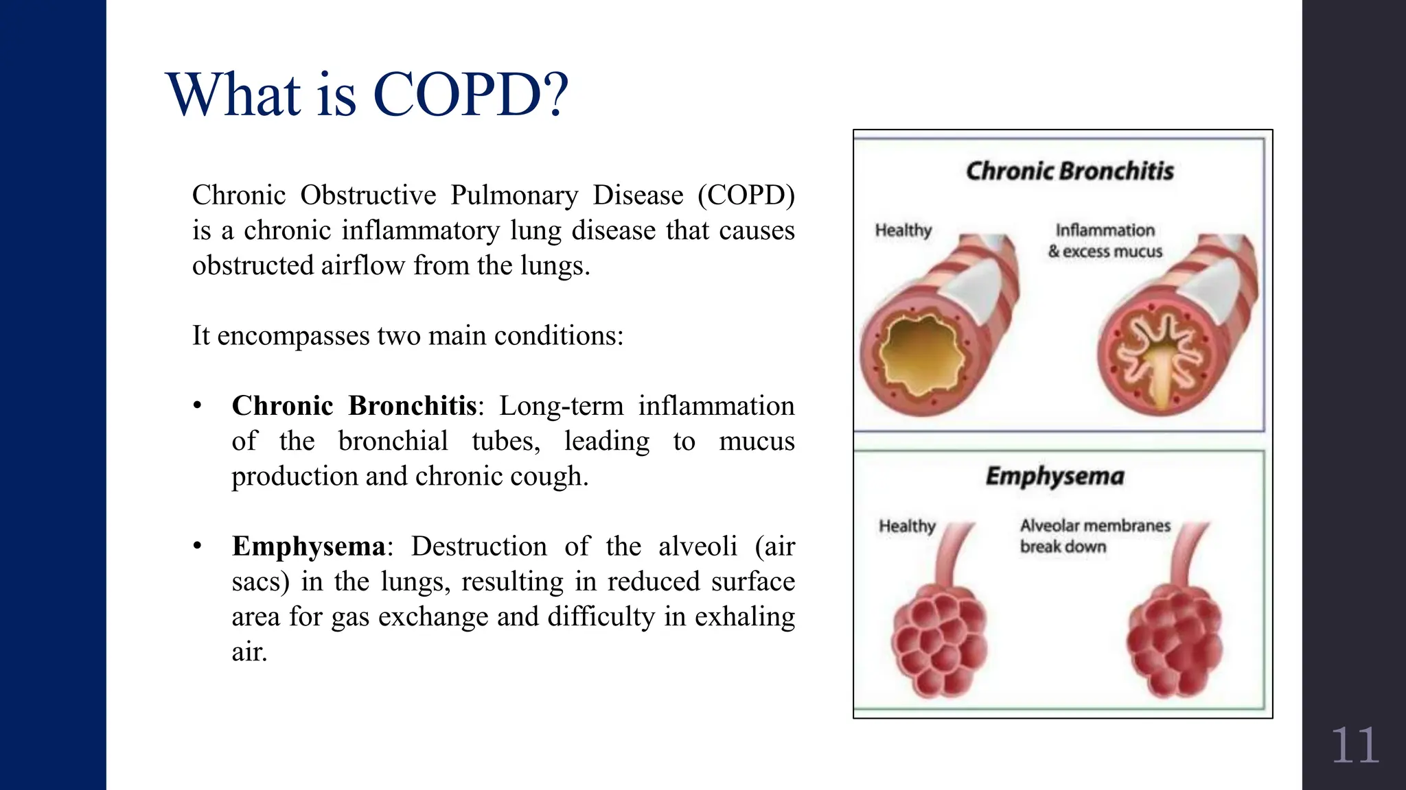 Pharmacotherapy of Asthma and Chronic Obstructive Pulmonary Disease (COPD) | PPTX