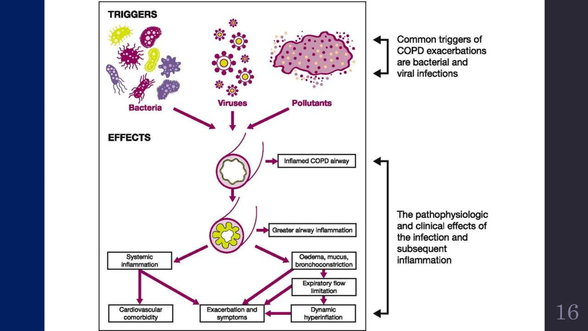 Pharmacotherapy of Asthma and Chronic Obstructive Pulmonary Disease ...