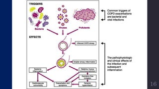 Pharmacotherapy of Asthma and Chronic Obstructive Pulmonary Disease (COPD) | PPTX
