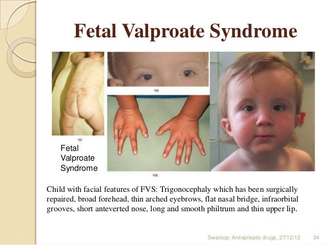Pharmacotherapy of epilepsy
