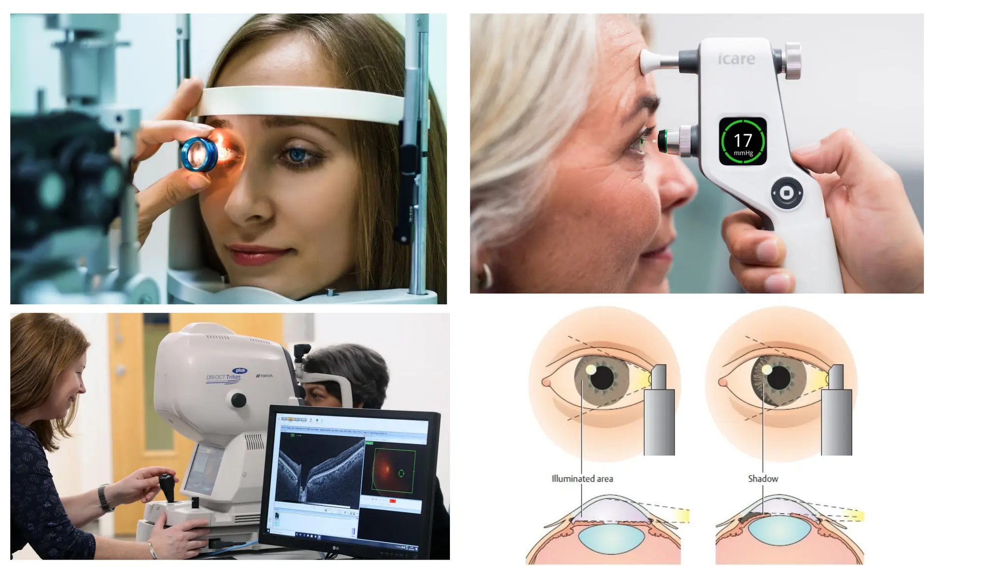 Definition, types, risk factors, classification of drugs used in glaucoma Pharmacotherapy of ...