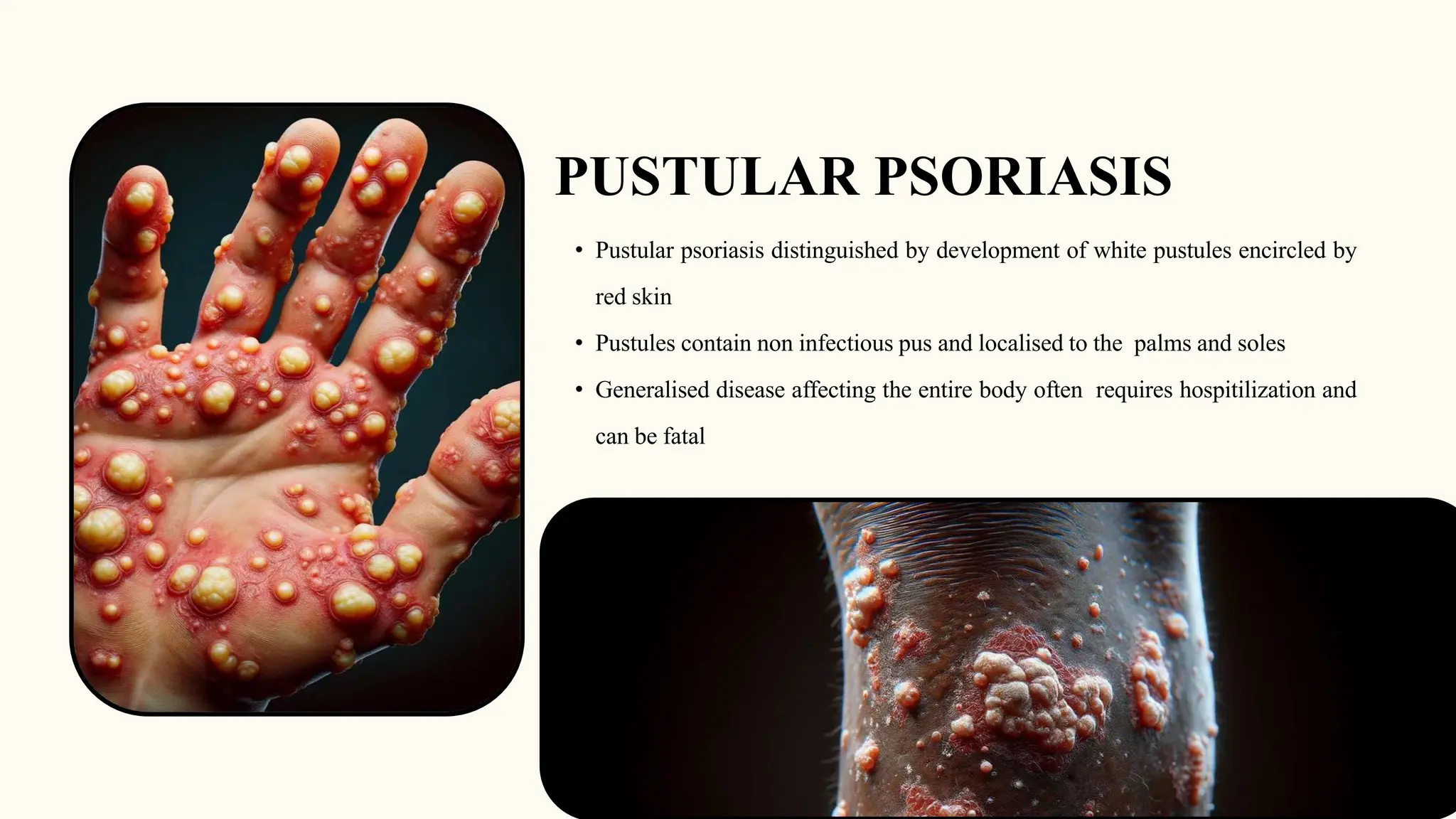 PHARMACOTHERAPY AND FUTURE PROSPECTS OF PSORIASIS.pptx