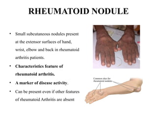 PHARMACOTHERAPY OF RHEUMATOID ARTHRITIS- BY DR. ANURAG SHARMA.pptx
