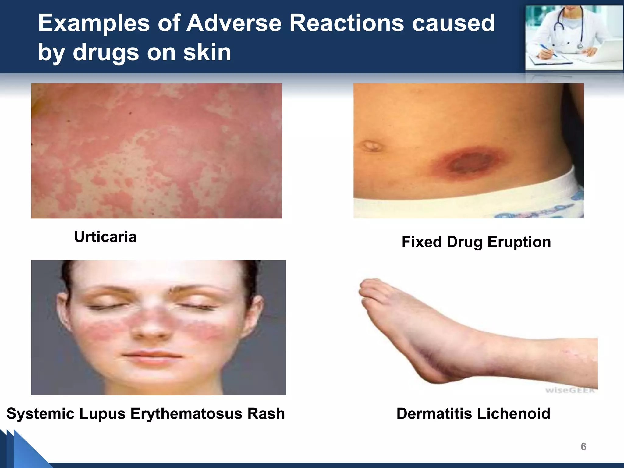 Pharmacovigilance | PPTX