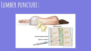 Cerebrospinalfluid(CSF) sampling | PPT