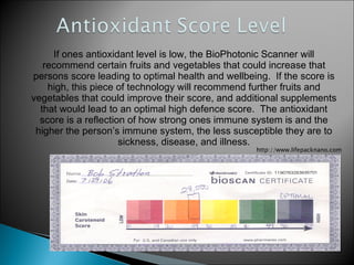 0753038: Pharmanex's Biophotonic Scanner | PPT