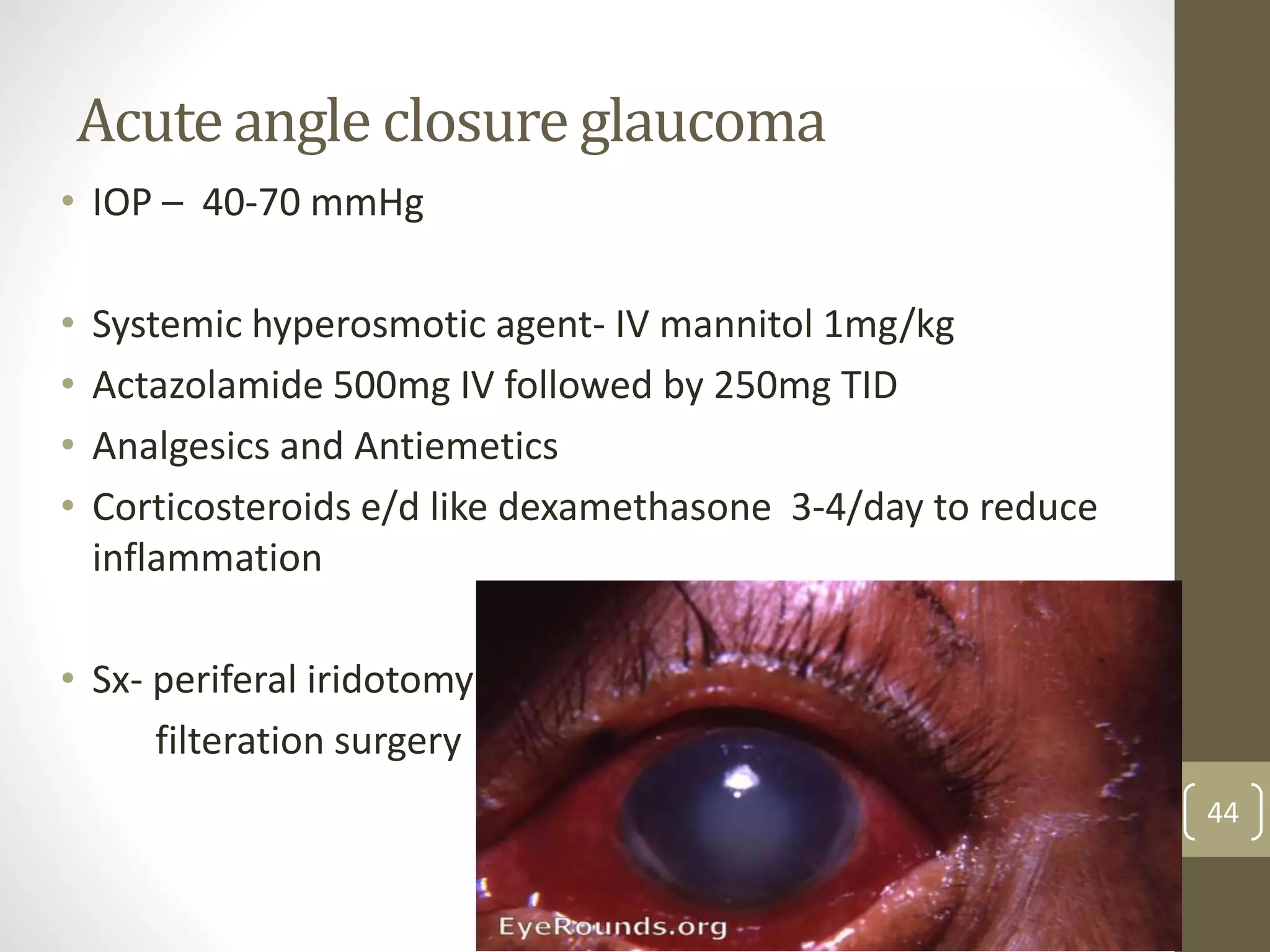 Pharmacotherapy of glaucoma | PPTX