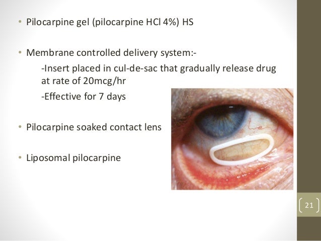 Pharmacotherapy of glaucoma