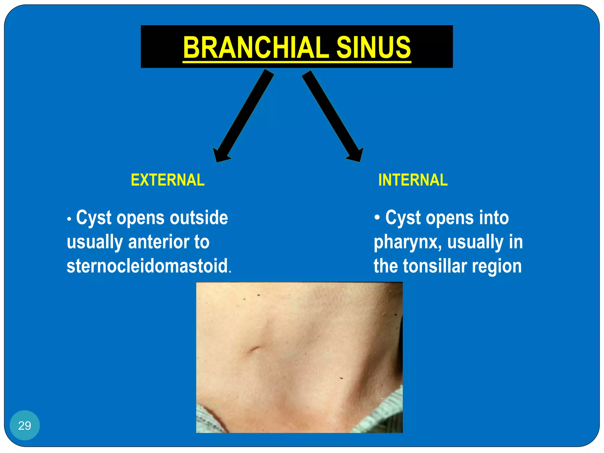 Pharyngeal arches | PPTX