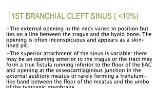 Pharyngeal arches and its anomaly | PPTX