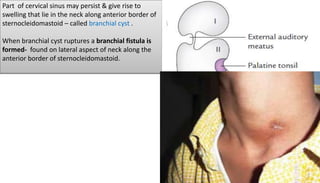 Pharyngeal arches & pouches | PPTX