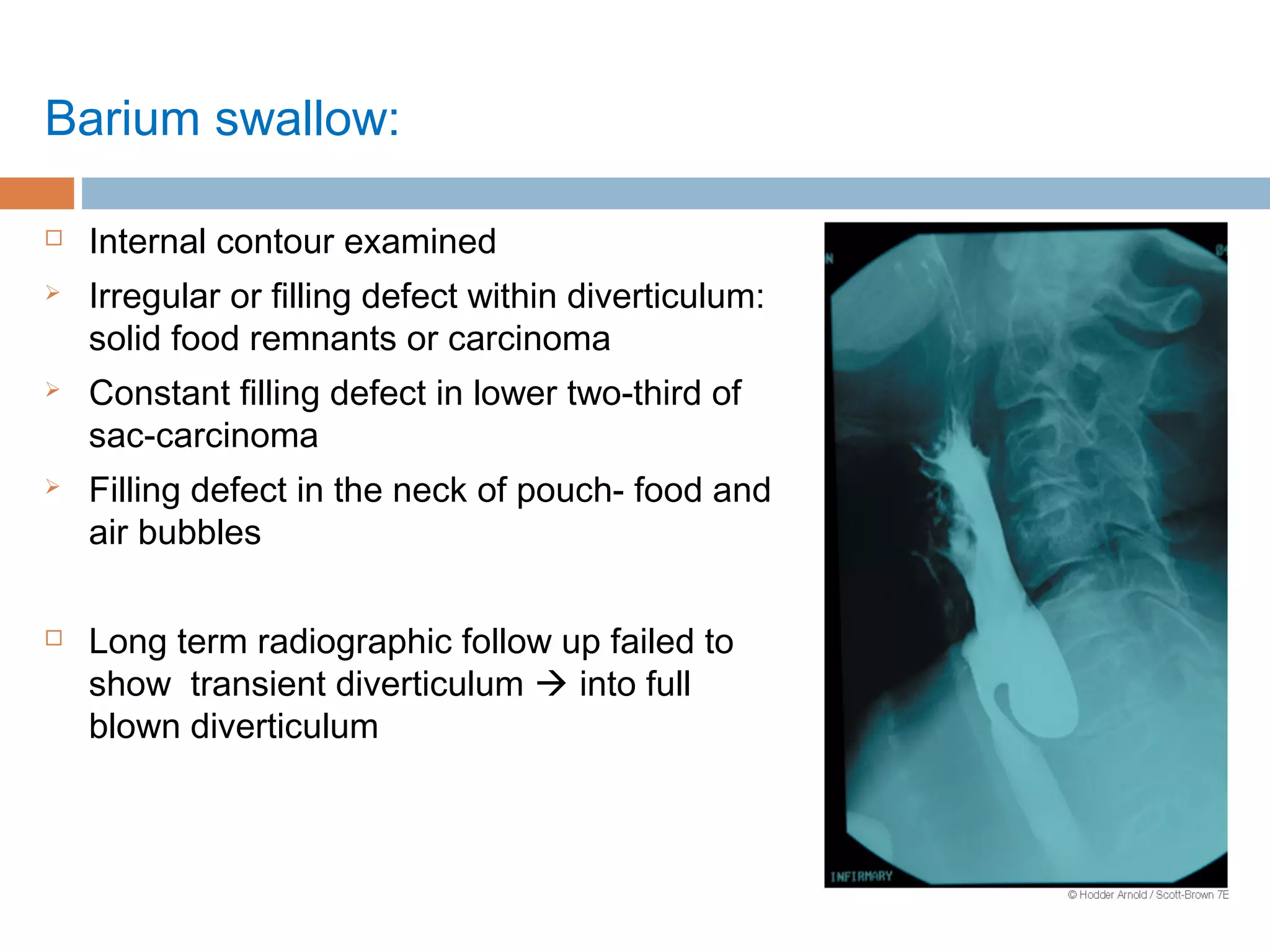 Pharyngeal pouches | PPT