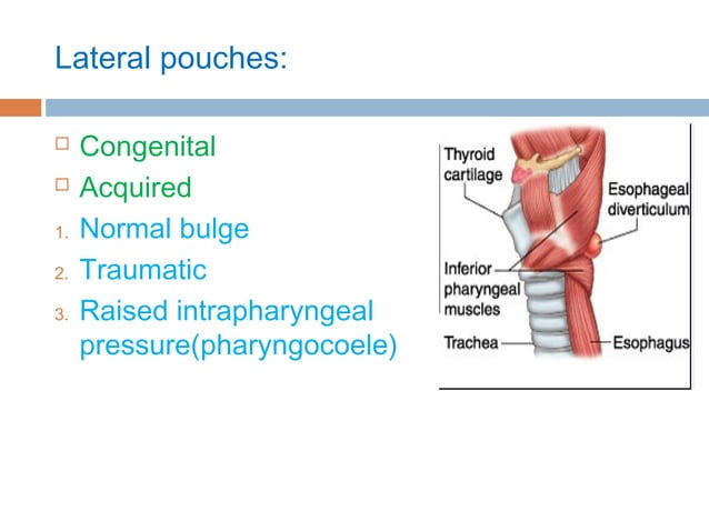 Pharyngeal pouches | PPT