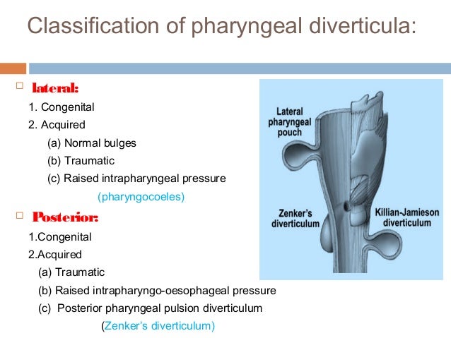 Pharyngeal pouches