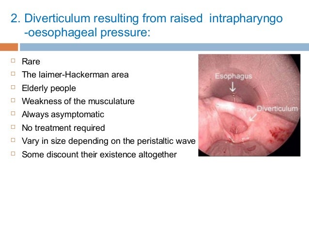 Pharyngeal pouches