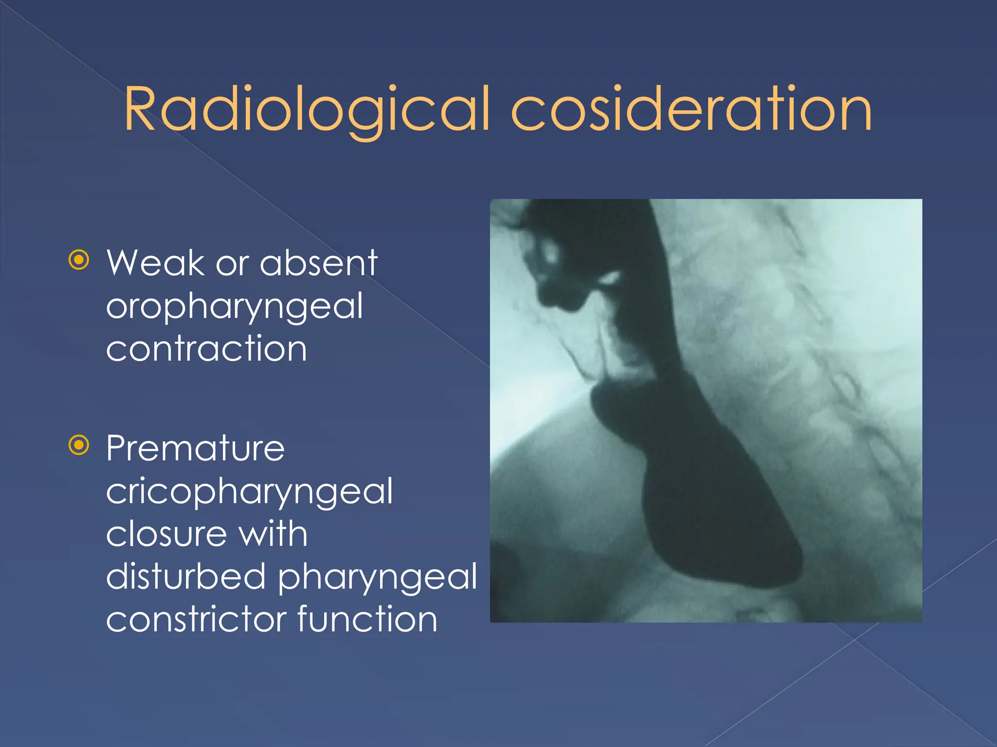 Pharyngeal pouches and its applied anatomy.pptx