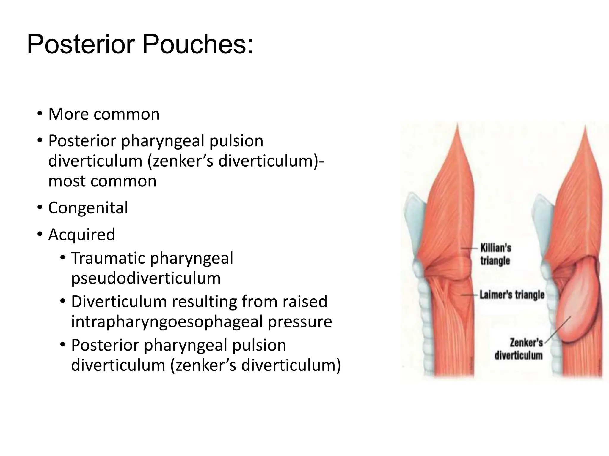 pharyngeal pouches uttam, pharyngoceles, laryngoceles.pptx