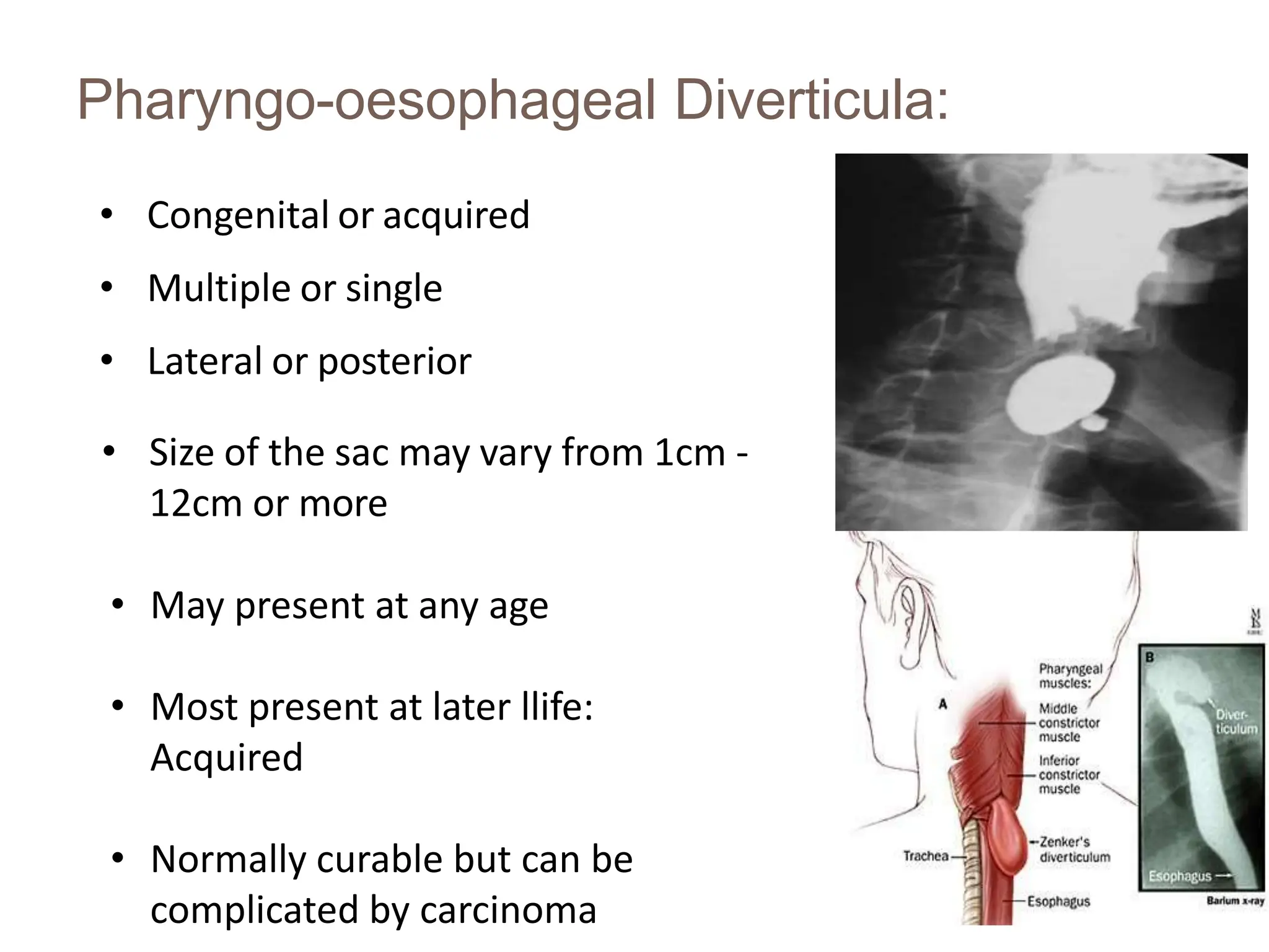 pharyngeal pouches uttam, pharyngoceles, laryngoceles.pptx