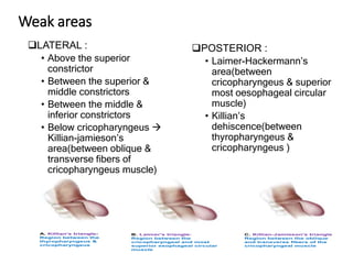 pharyngeal pouches uttam, pharyngoceles, laryngoceles.pptx