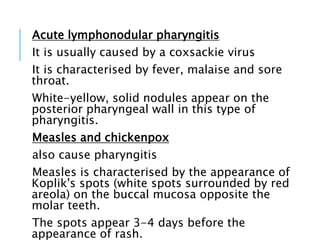 Pharyngitis | PPTX