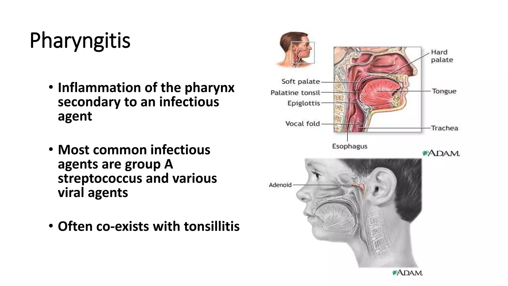 Pharyngitis | PPTX