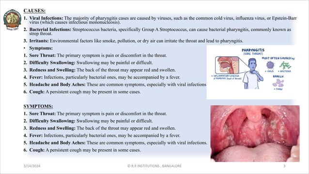 PHARYNGITIS AND ITS NURSING MANAGEMENT.pdf | Ear, Nose and Throat Conditions | Diseases and ...